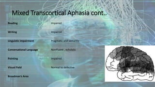 Characteristics of Non Fluent aphasia | PPSX | Brain and Nervous System ...