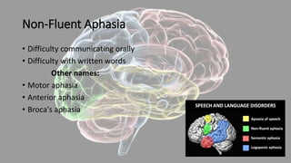 Characteristics of Non Fluent aphasia | PPSX | Brain and Nervous System ...