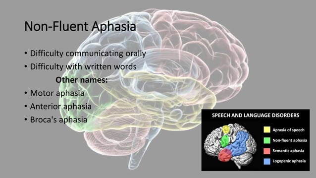 Characteristics of Non Fluent aphasia | PPSX | Brain and Nervous System ...