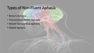 Characteristics of Non Fluent aphasia | PPSX | Brain and Nervous System ...