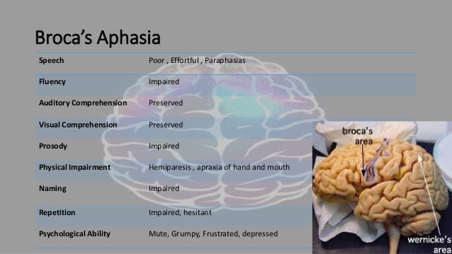 Characteristics of Non Fluent aphasia