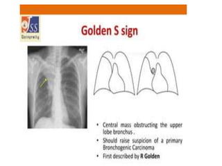 presentation S sign.pptx