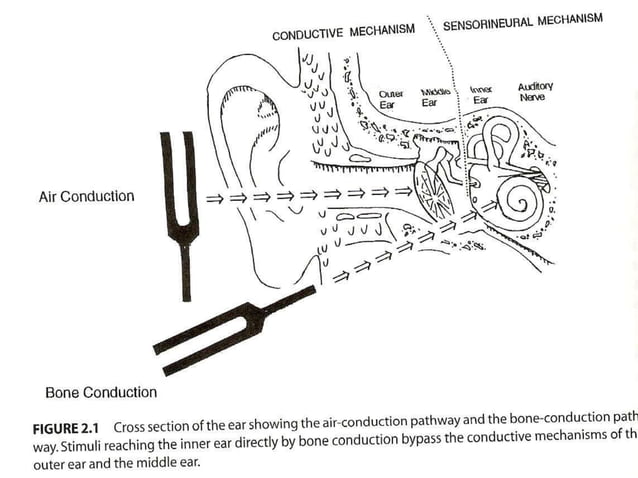 TESTS FOR AUDITORY ASSESSMENT | PPTX