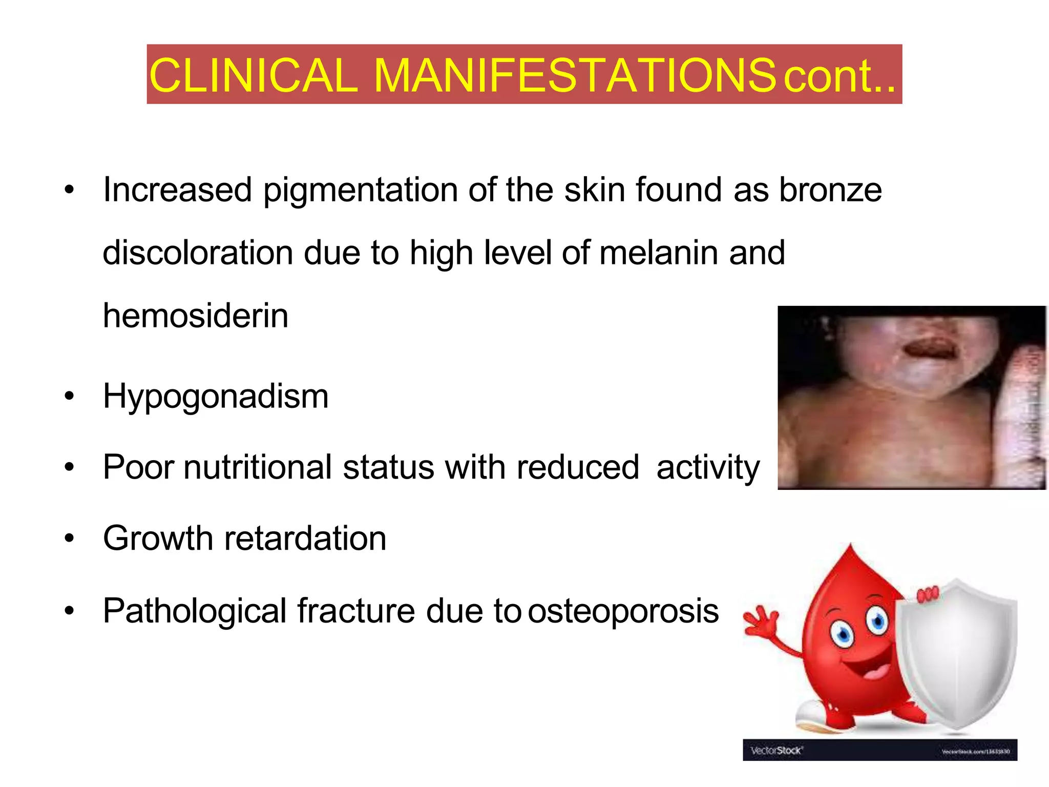 REVIEW OF THALASSEMIA | PPTX