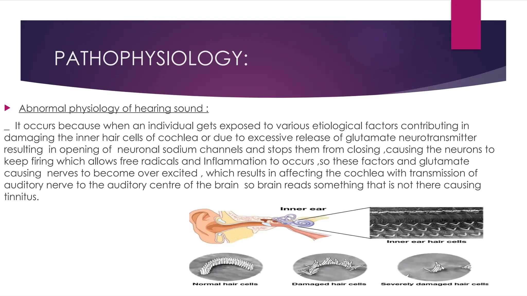 Presentation (Tinnitus).pptx Tinnitus disease is a ear disorder | PPTX