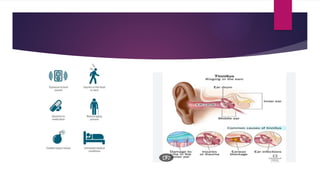 Presentation (Tinnitus).pptx Tinnitus disease is a ear disorder | PPTX
