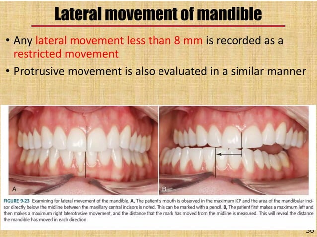 Presentation TMJ.pptx TMG imaging techniques . | PPTX