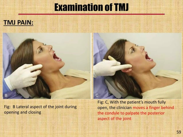 Presentation TMJ.pptx TMG imaging techniques . | PPTX