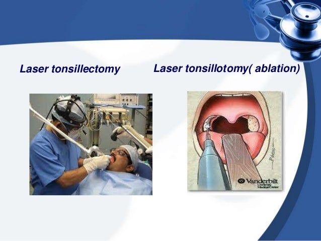 Tonsillectomy