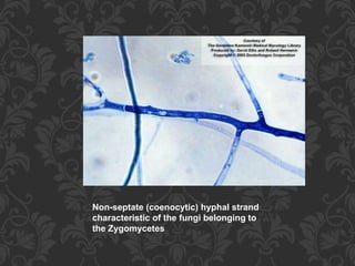 Zygomycosis | PPTX
