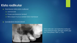 Presentasi Kista Odontogenik dan Tumor Odontogenik - Willi Fragcana ...
