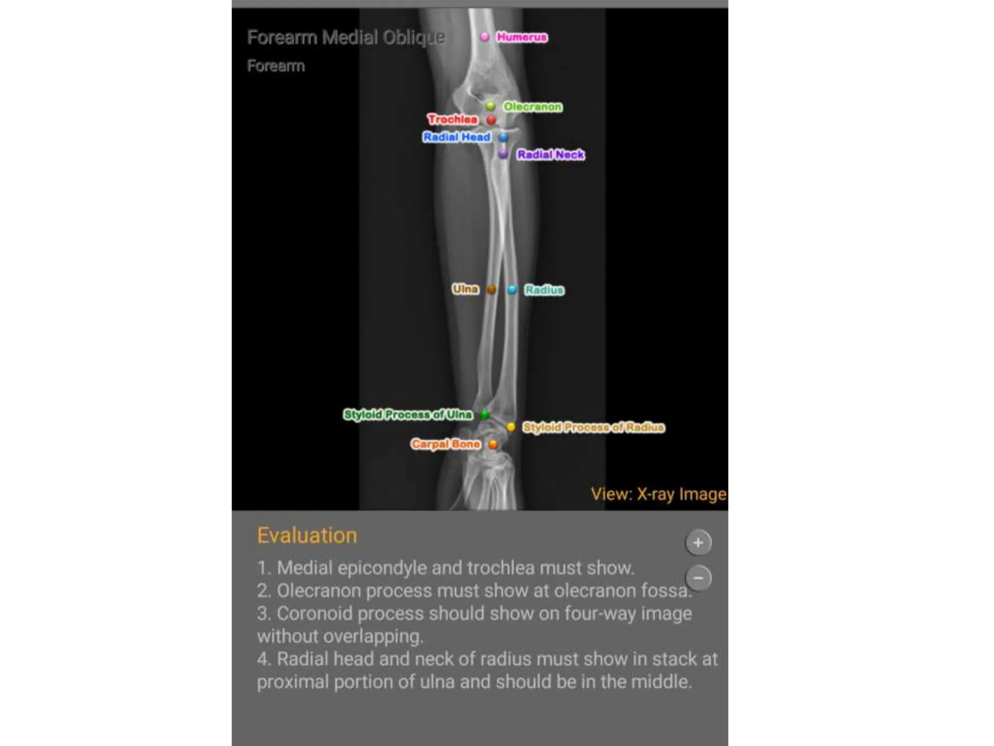 Presentation UPPER LIMB.pptx it is about x ray positioning of upper ...