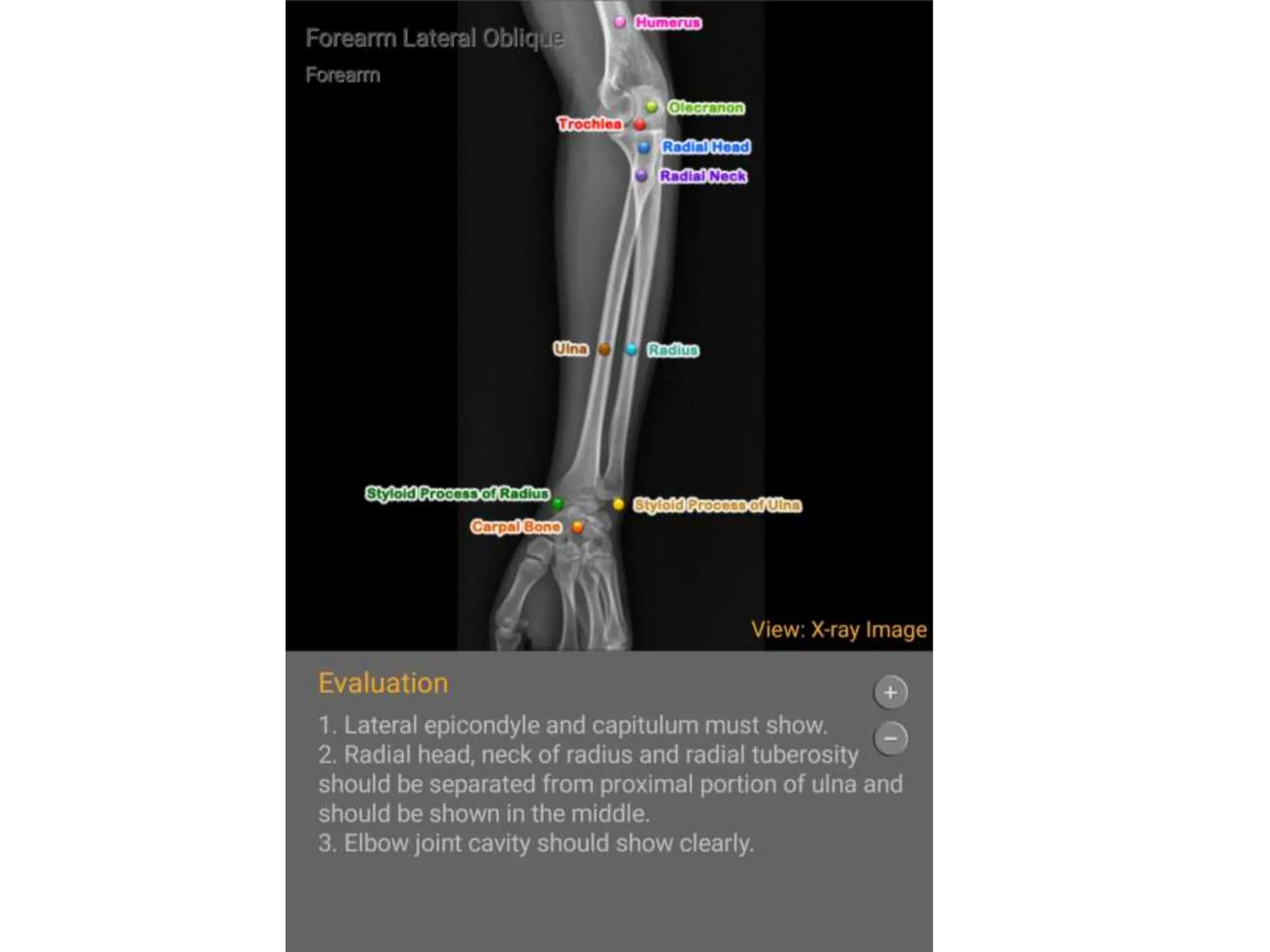 Presentation UPPER LIMB.pptx it is about x ray positioning of upper ...