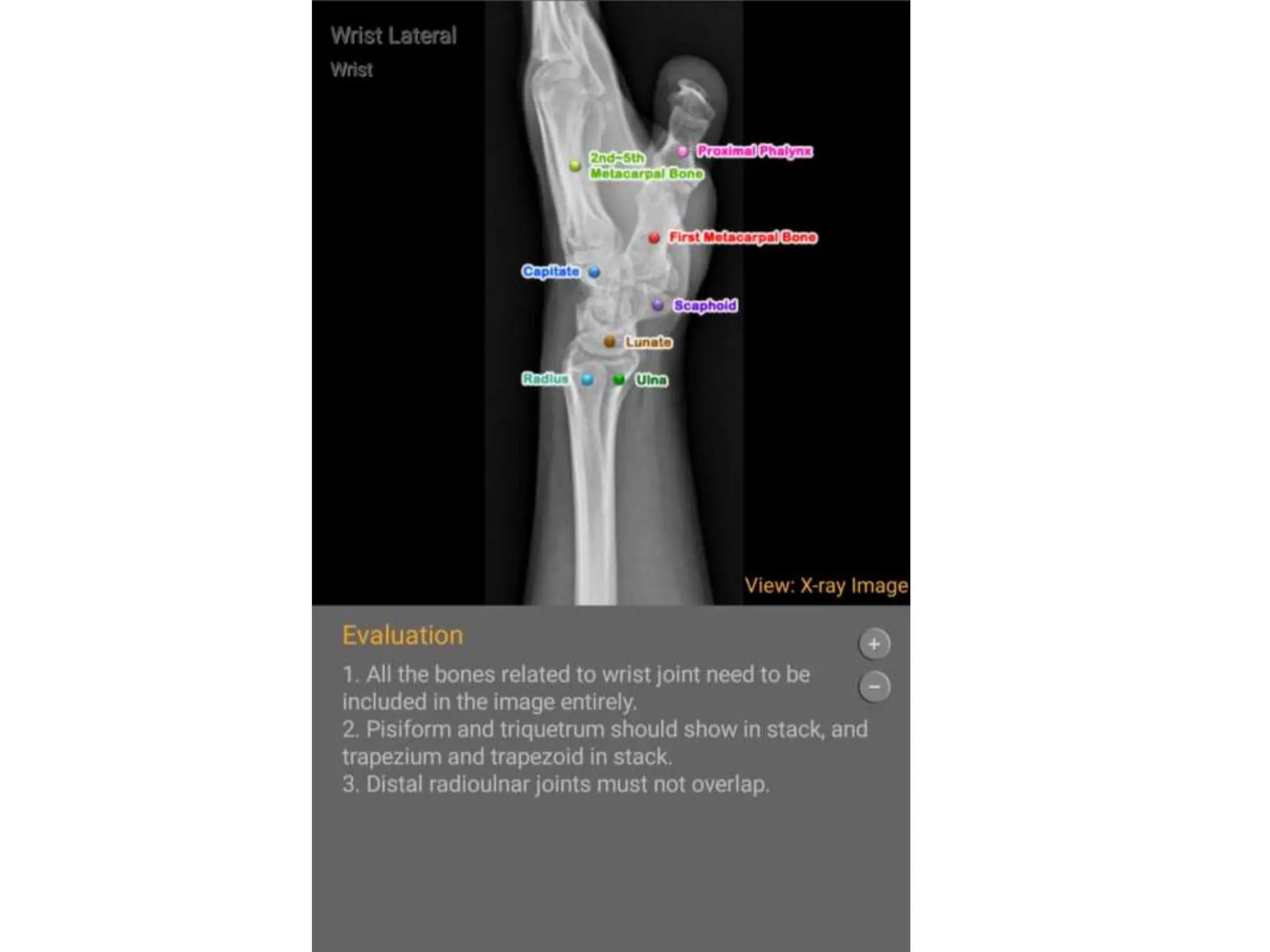 Presentation UPPER LIMB.pptx it is about x ray positioning of upper ...