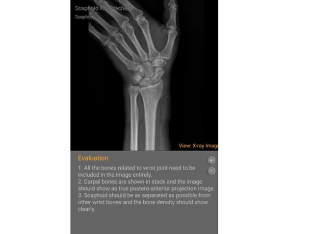 Presentation UPPER LIMB.pptx it is about x ray positioning of upper ...