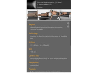 Presentation UPPER LIMB.pptx it is about x ray positioning of upper ...