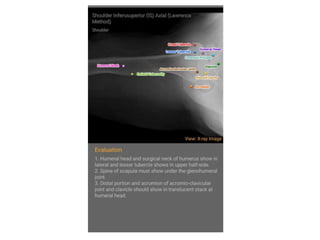 Presentation UPPER LIMB.pptx it is about x ray positioning of upper ...