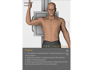 Presentation UPPER LIMB.pptx it is about x ray positioning of upper ...