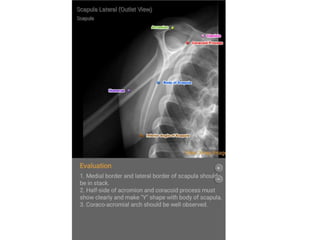 Presentation UPPER LIMB.pptx it is about x ray positioning of upper ...