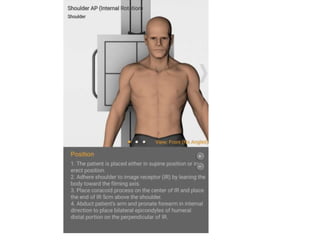Presentation UPPER LIMB.pptx it is about x ray positioning of upper ...