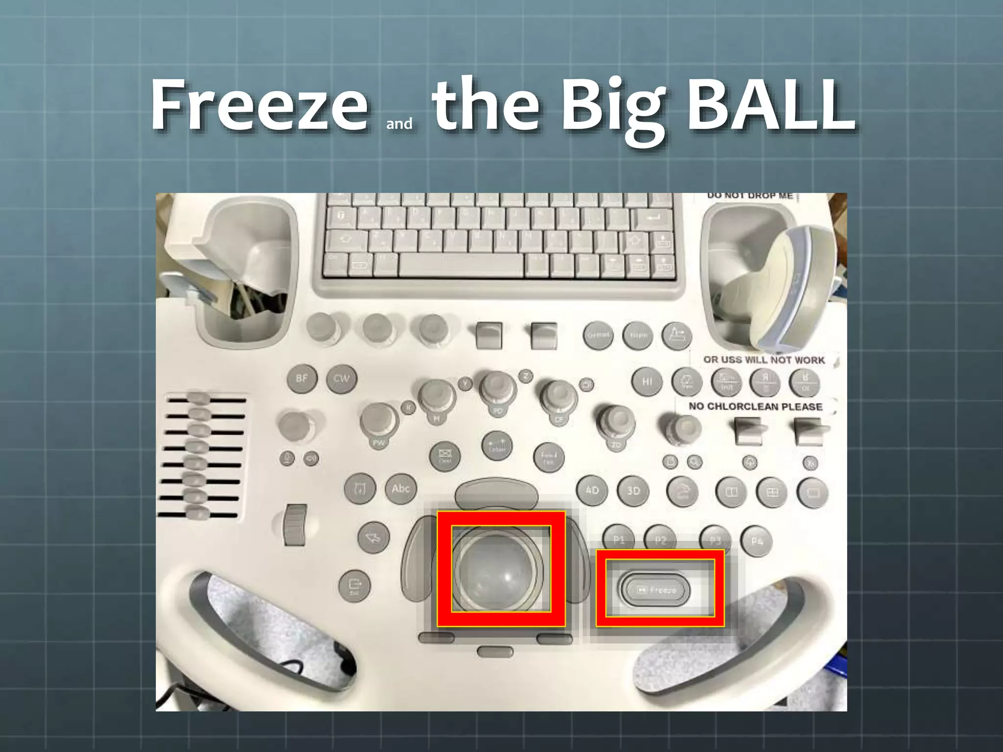 Basic Labour Ward Ultrasound 101 | PPTX