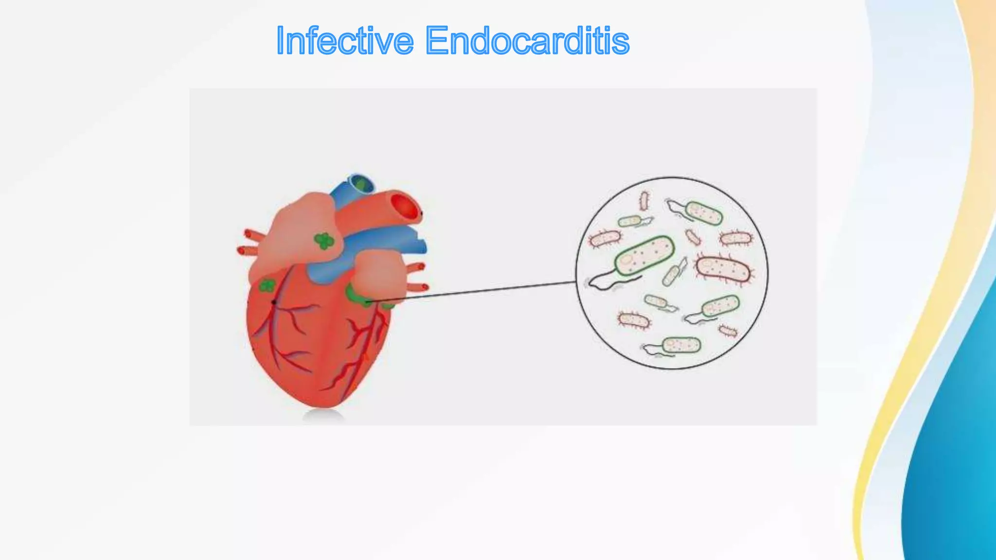 Infective Endocarditis | PPTX