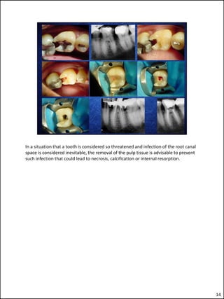 Evidence of pulp disease in the inlayed teeth of the ancient Mayans: a ...