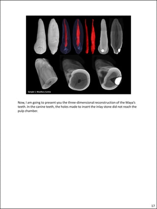 Evidence of pulp disease in the inlayed teeth of the ancient Mayans: a ...