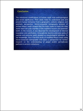 Evidence of pulp disease in the inlayed teeth of the ancient Mayans: a ...