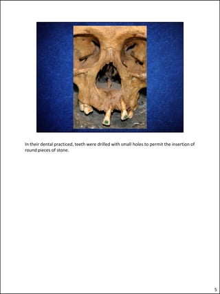 Evidence of pulp disease in the inlayed teeth of the ancient Mayans: a ...