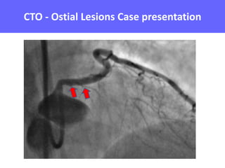 Valeri Gelev - Ostial CTO Lesions | PPT