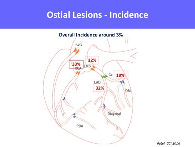 Valeri Gelev - Ostial CTO Lesions