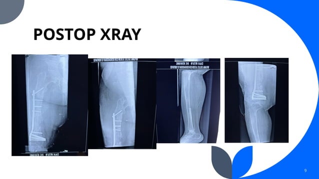 Presentation bgh bcfh vfyh guyzainab.pptx