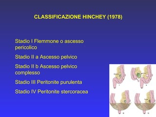 Laparoscopia e peritonite: malattia diverticolare | PPT