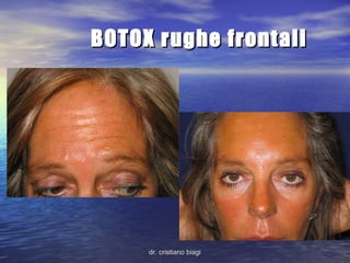 Prima e Dopo: alcuni casi di medicina e chirurgia estetica | PPT