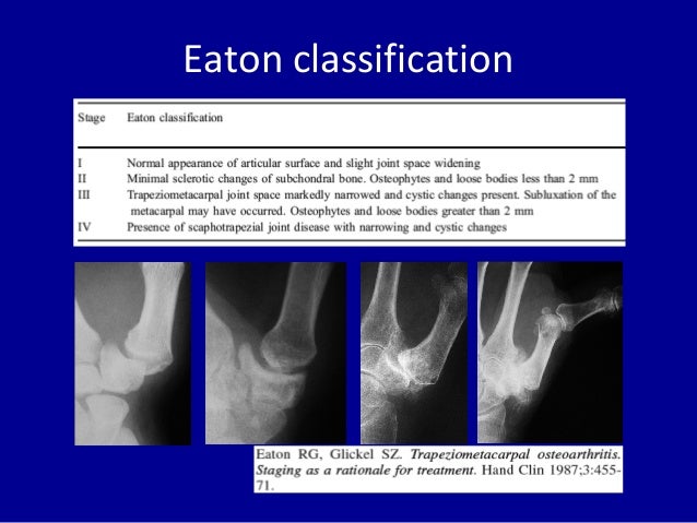 Dr. R.Mele presenta "La chirurgia.mano"