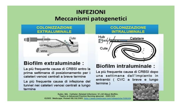 Presentazione infezioni cvc.pptx