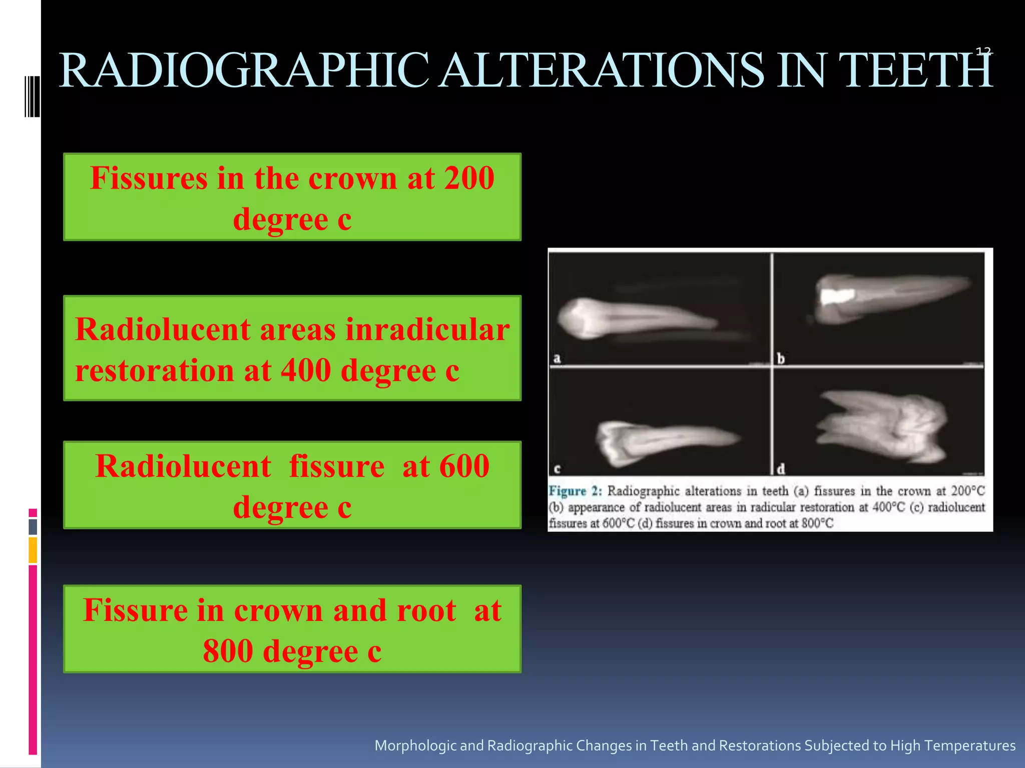 MORPHOLOGICAL AND RADIOGRAPHIC CHANGES IN TEETH AND RESTORATION ...