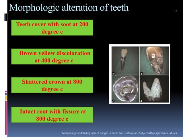 MORPHOLOGICAL AND RADIOGRAPHIC CHANGES IN TEETH AND RESTORATION ...