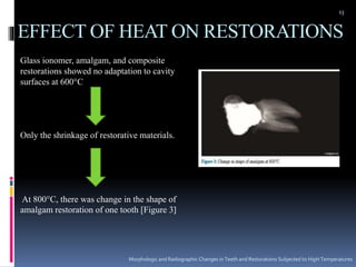 MORPHOLOGICAL AND RADIOGRAPHIC CHANGES IN TEETH AND RESTORATION ...