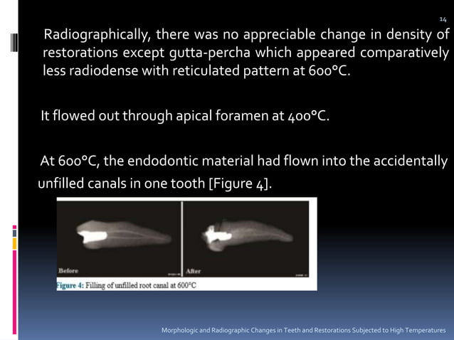 MORPHOLOGICAL AND RADIOGRAPHIC CHANGES IN TEETH AND RESTORATION ...