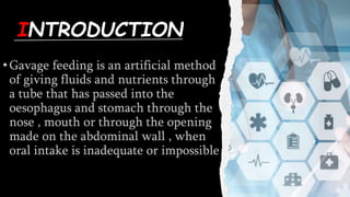 NASOGASTRIC TUBE FEEDING or NG tube feeding | PPTX