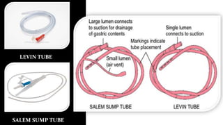 NASOGASTRIC TUBE FEEDING or NG tube feeding | PPTX