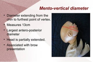 Presenting diameters | PPT