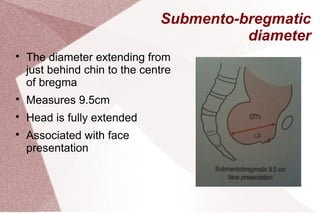 Presenting diameters | PPT