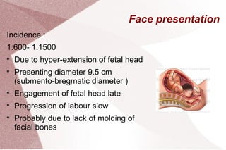 Presenting diameters | PPT