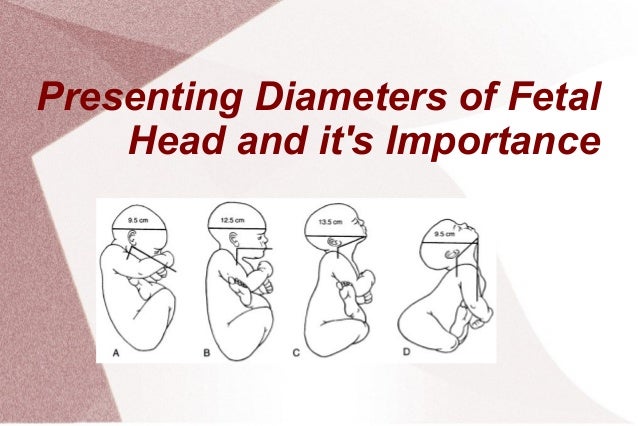 Presenting diameters