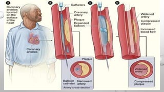 presentation on open and close heart surgery | PPTX