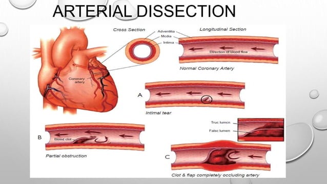 presentation on open and close heart surgery | PPTX