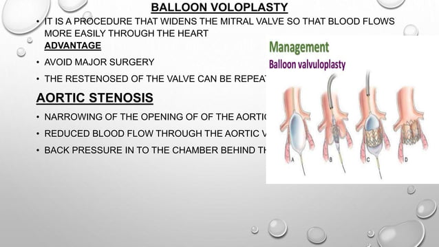 presentation on open and close heart surgery | PPTX